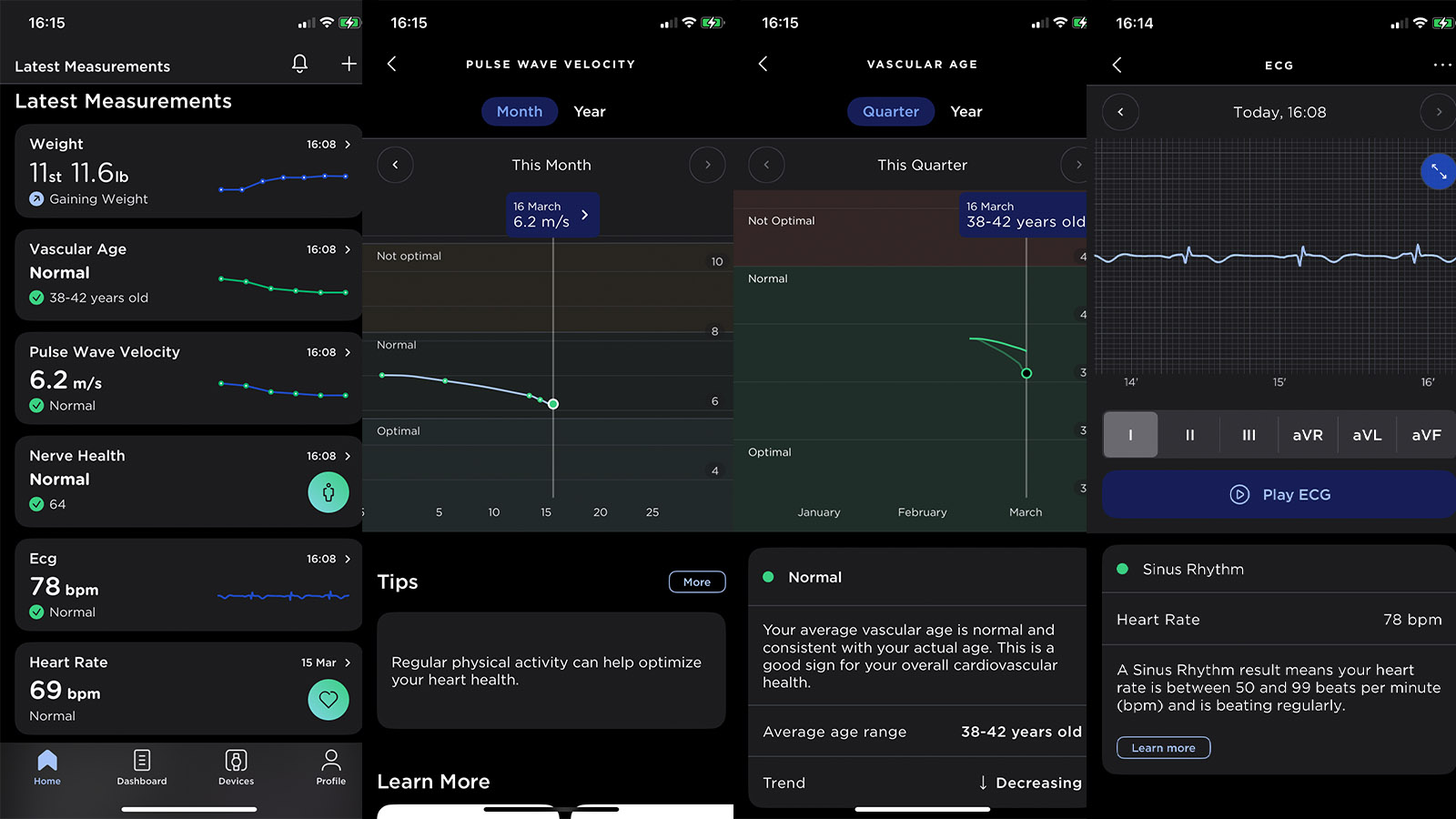 Withings Body Scan review: An early warning system for health | TechHive