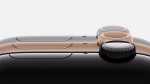 Thinnest-ever Apple Watch Series 10 is here with larger display, health ...
